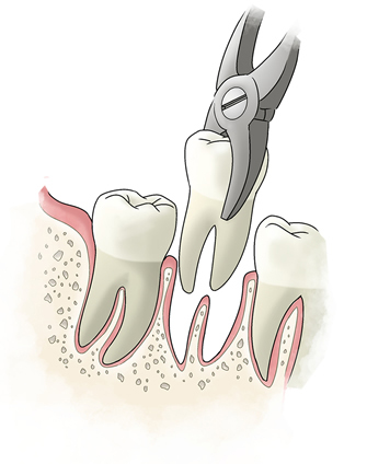 Oral Surgery - Kians Dental Studio